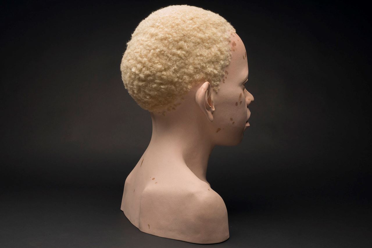Africa Child with Albinism No. 3 | Hieronymus Objects