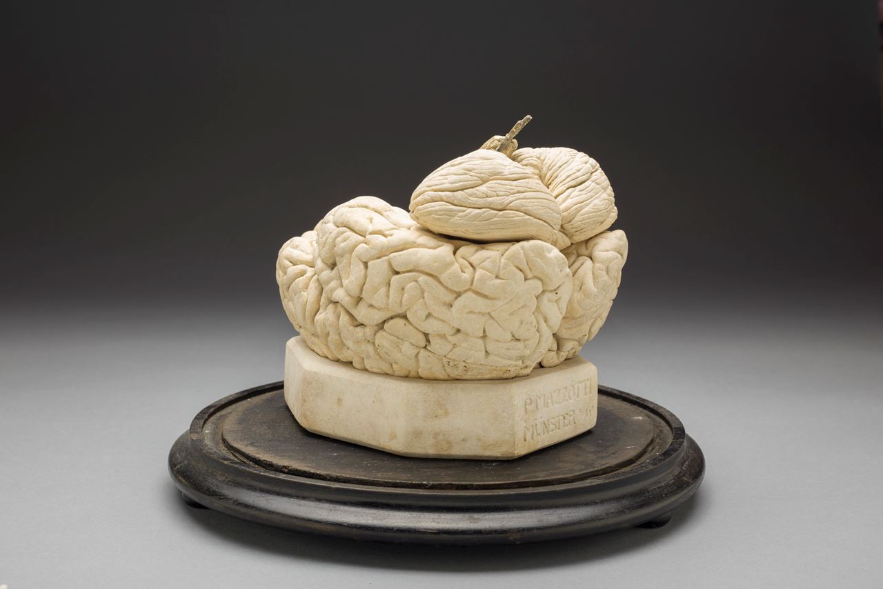 Brain Medical Model | Hieronymus Objects