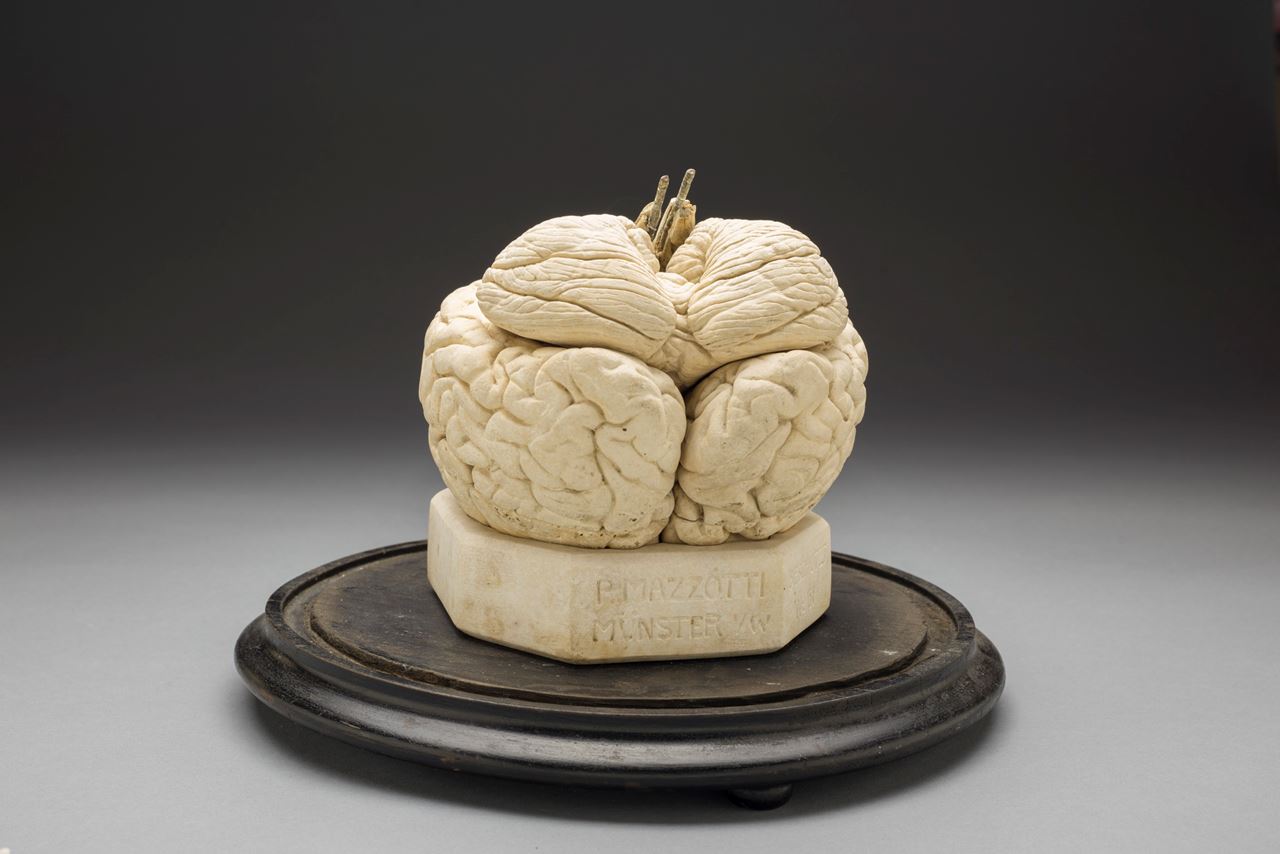 Brain Medical Model | Hieronymus Objects
