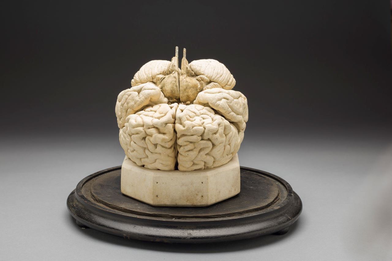 Brain Medical Model | Hieronymus Objects